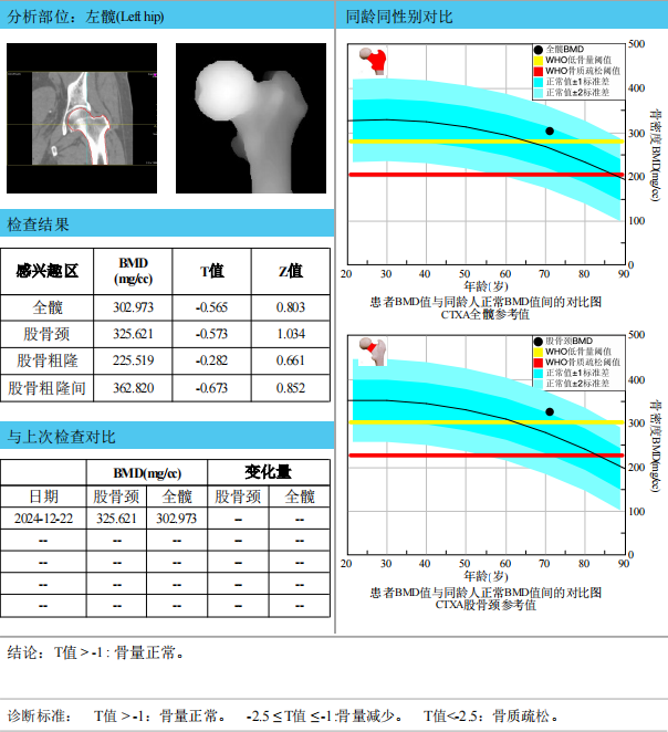 【眼科医院健康科普】QCT：一次CT扫描，两个结果