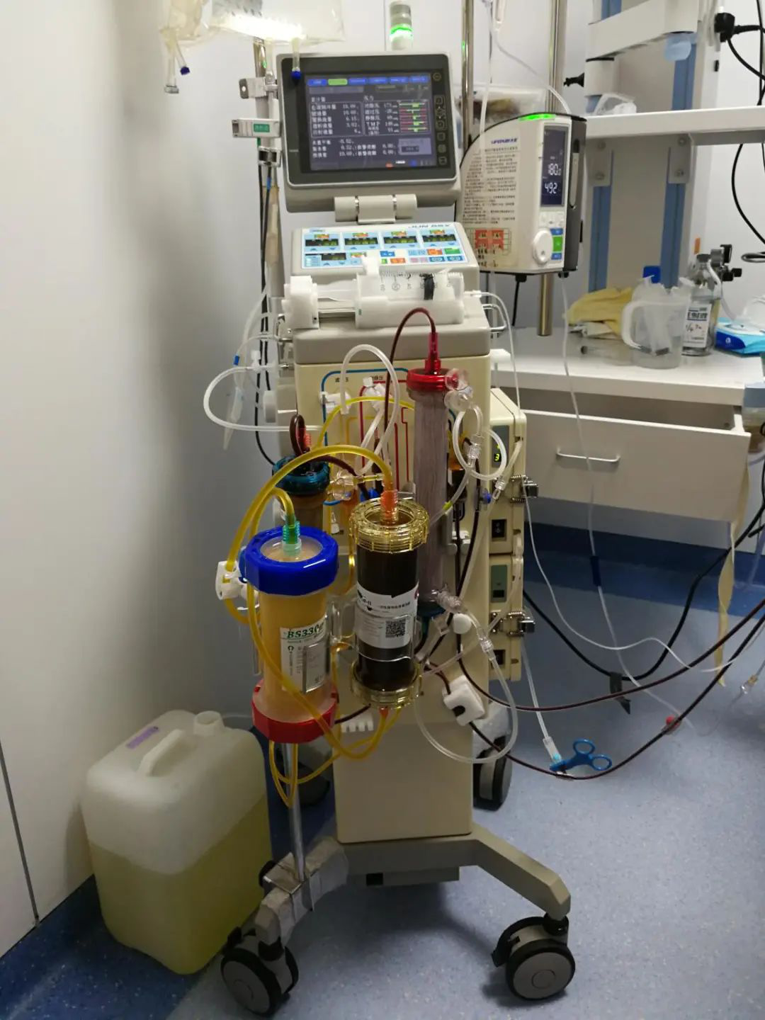 民航总医院血液透析中心成功开展DPMAS技术