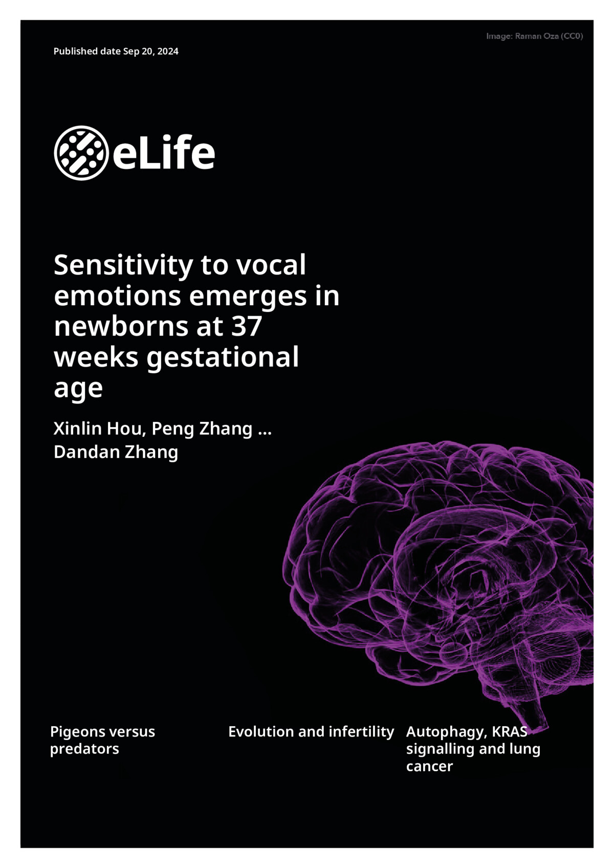 eLife封面论文|侯新琳教授团队合作研究解码新生儿情绪信息